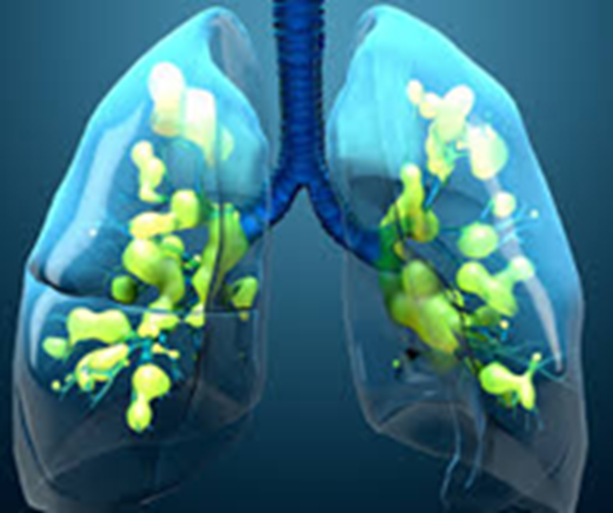 Why do we cough? Is the mucus accumulated in the lungs dangerous for us ...